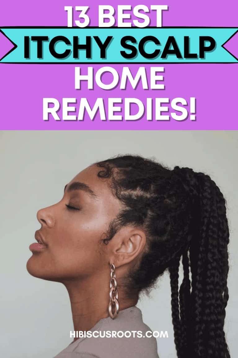 13 Natural Itchy Scalp Home Remedies for Instant Relief! – Hibiscus Roots